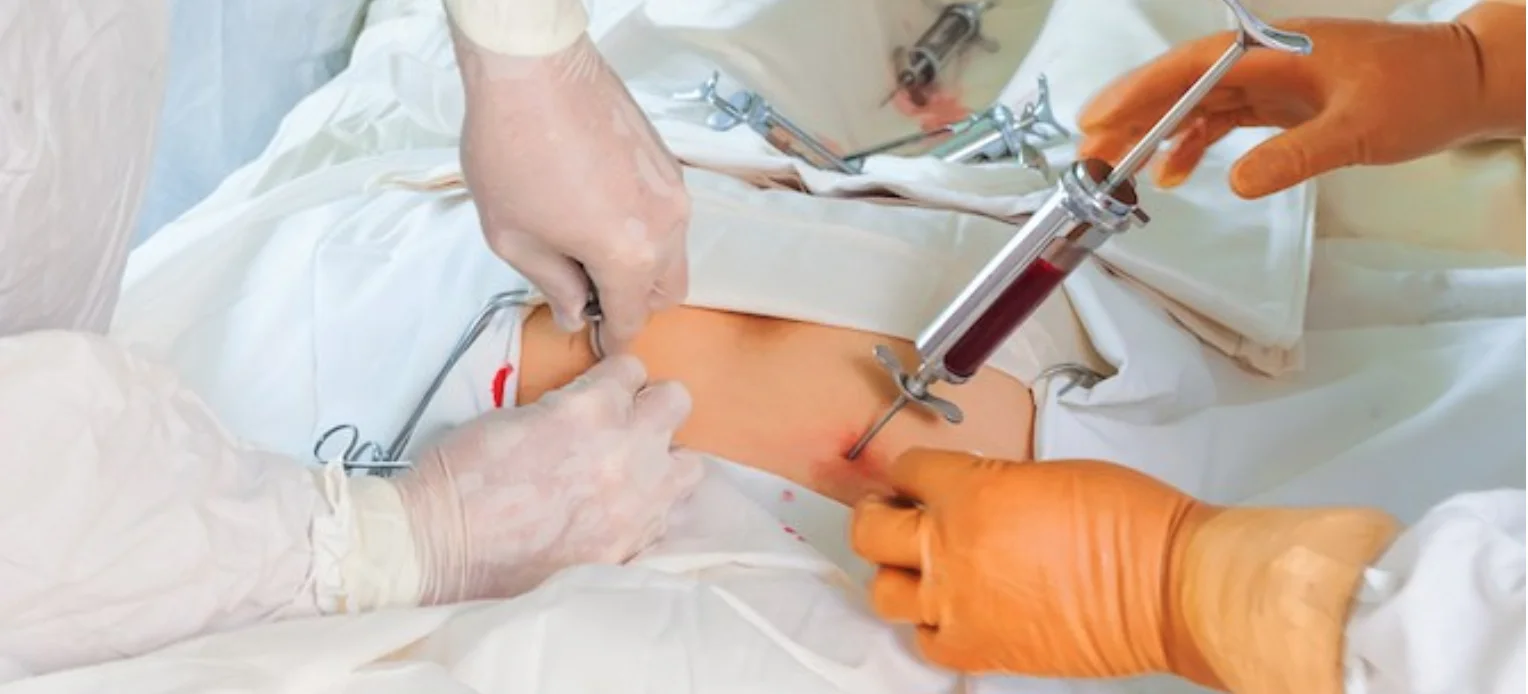 Autologous Procedure