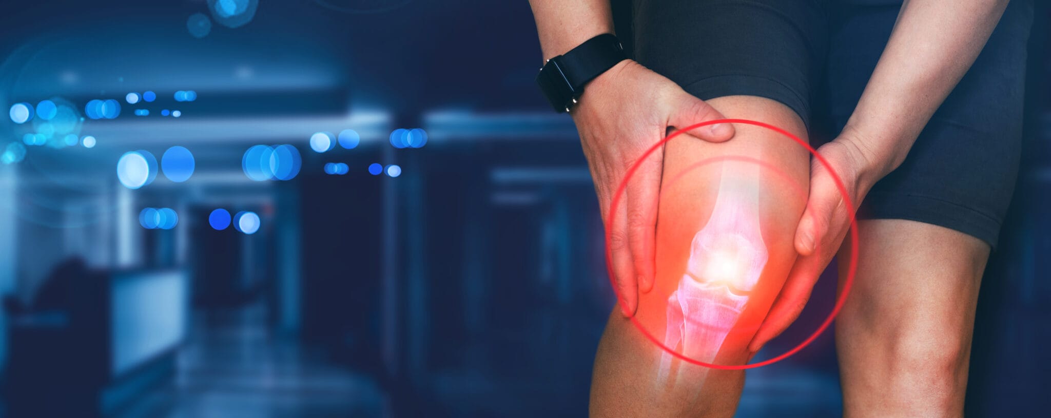 Anterior Cruciate Ligament (ACL) Injury - CubaHeal